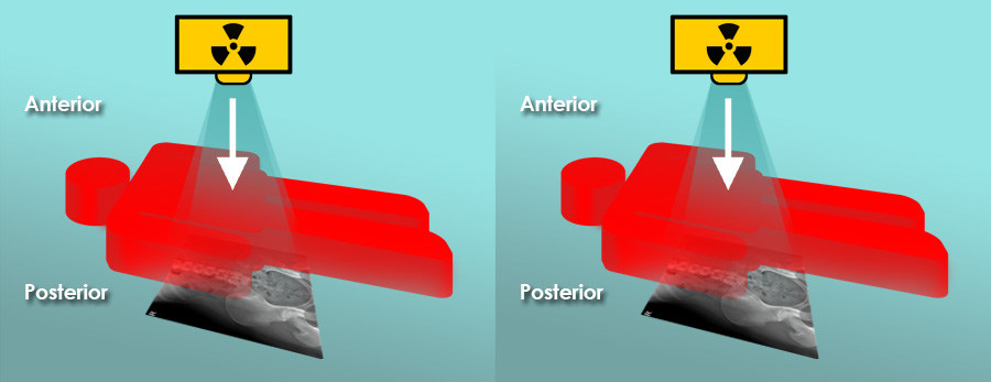 Abdominal X-ray - System and anatomy - Image data and quality
