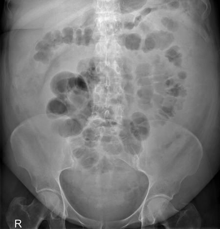 Radiology Masterclass