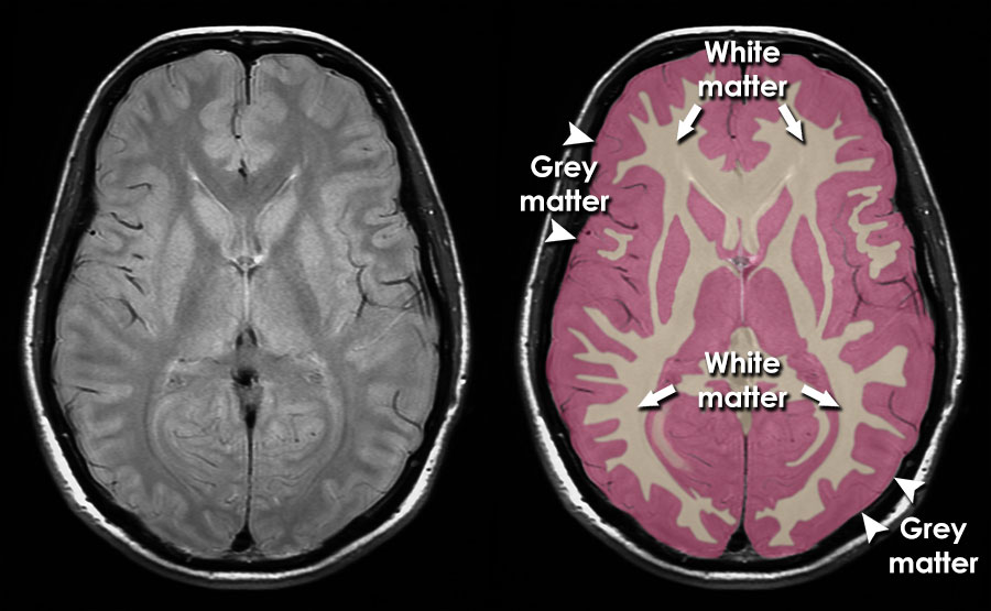 MRI interpretation - Application of MRI