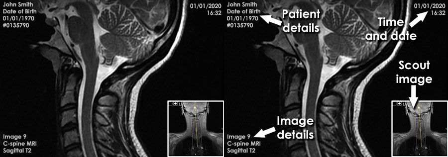 MRI interpretation - Systematic approach