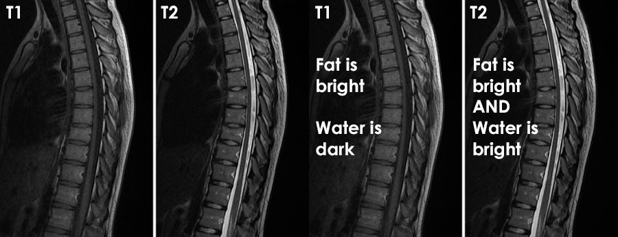 MRI interpretation - MRI signal production
