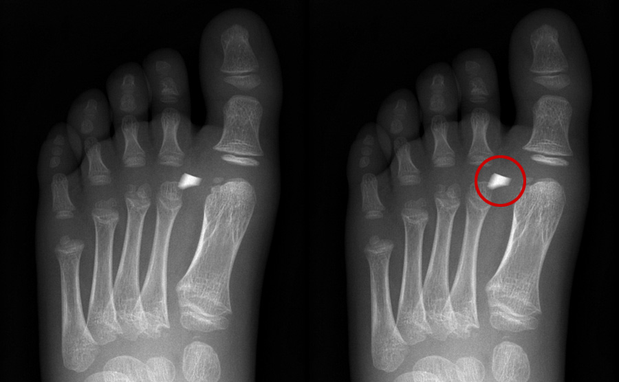 Gallery Xray Body