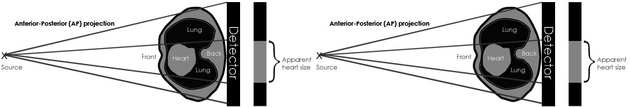 Basics of X-ray Physics - The X-ray beam