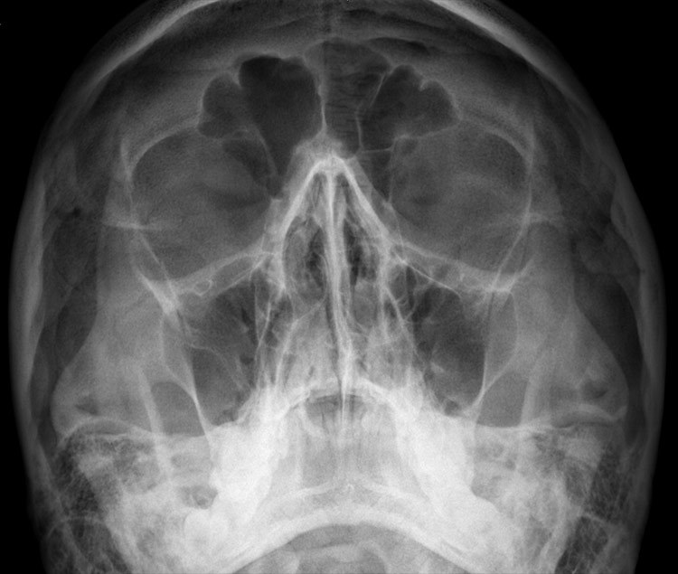 Radiology Masterclass Radiology Courses | Radiopaedia.org